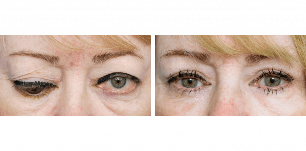 Thyroid Disease Before & After Transformations | Raymond Douglas